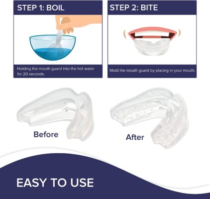 How to Mold a Snoring Mouthguard | Step-by-Step Guide